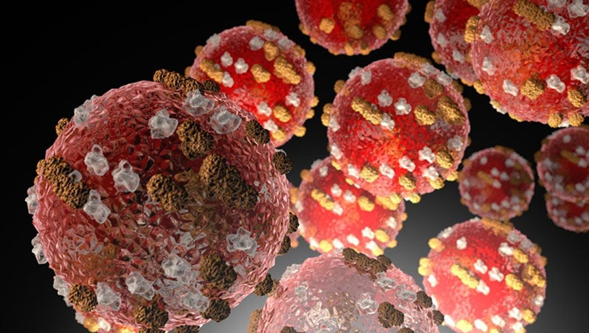 Measles case reported in NC