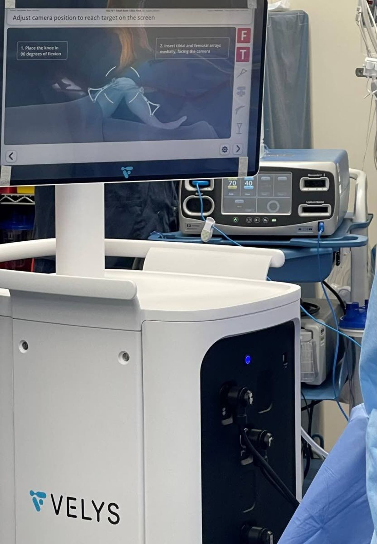 Nifty knee-replacement robot gets St. Joe’s patients back on their fee...