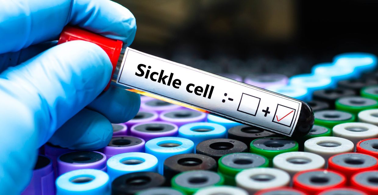 Sickle Cell Walk and Ball dates announced