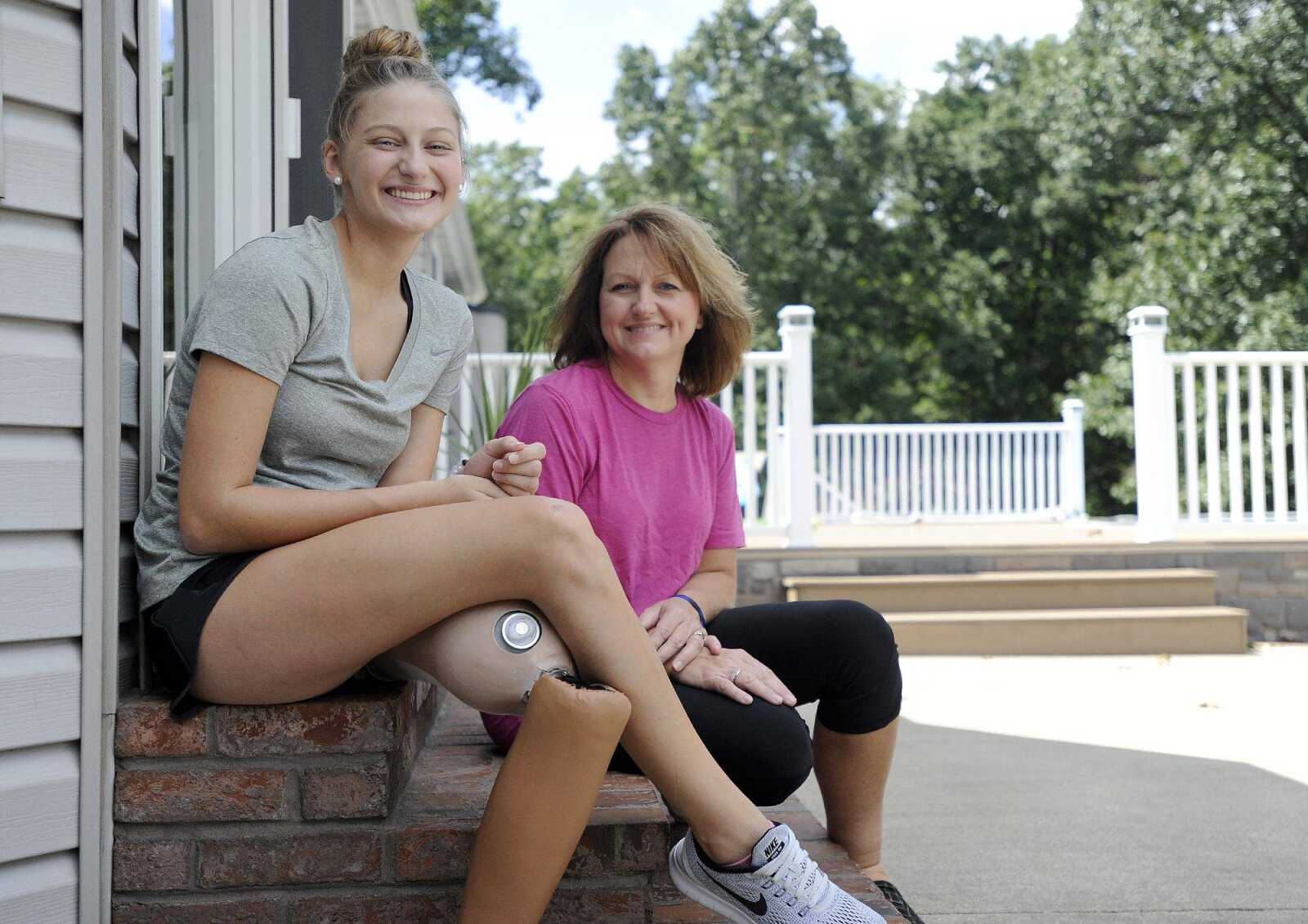 Perryville teen plays volleyball despite leg amputation