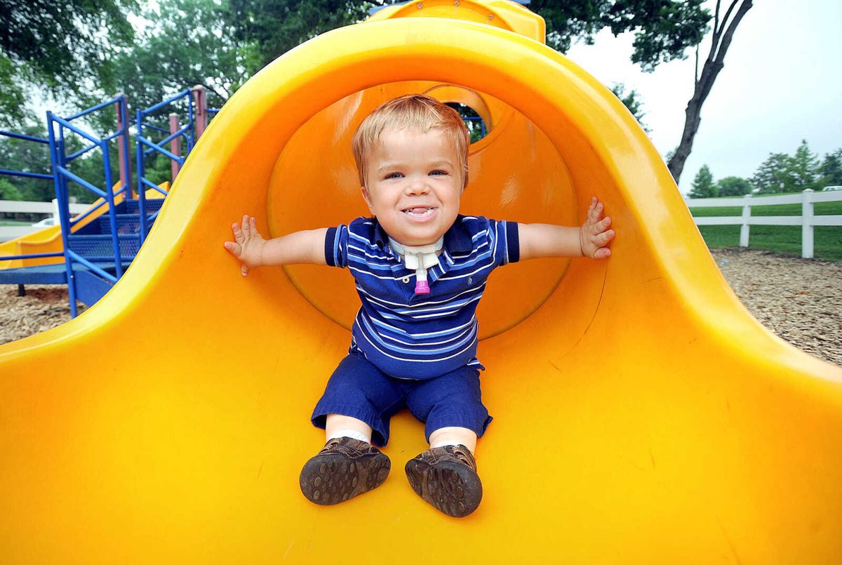 Living with Dwarfism