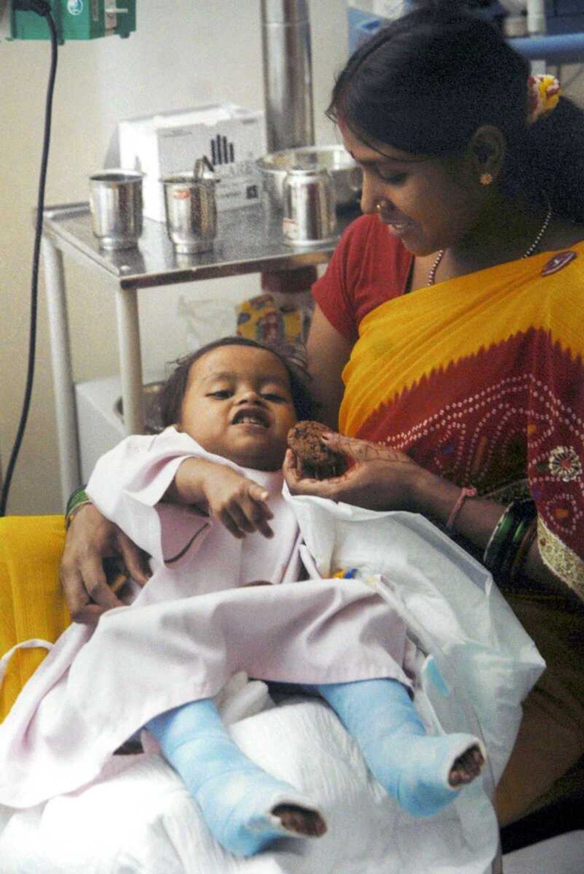 Indian girl born with 8 limbs healthy after surgery